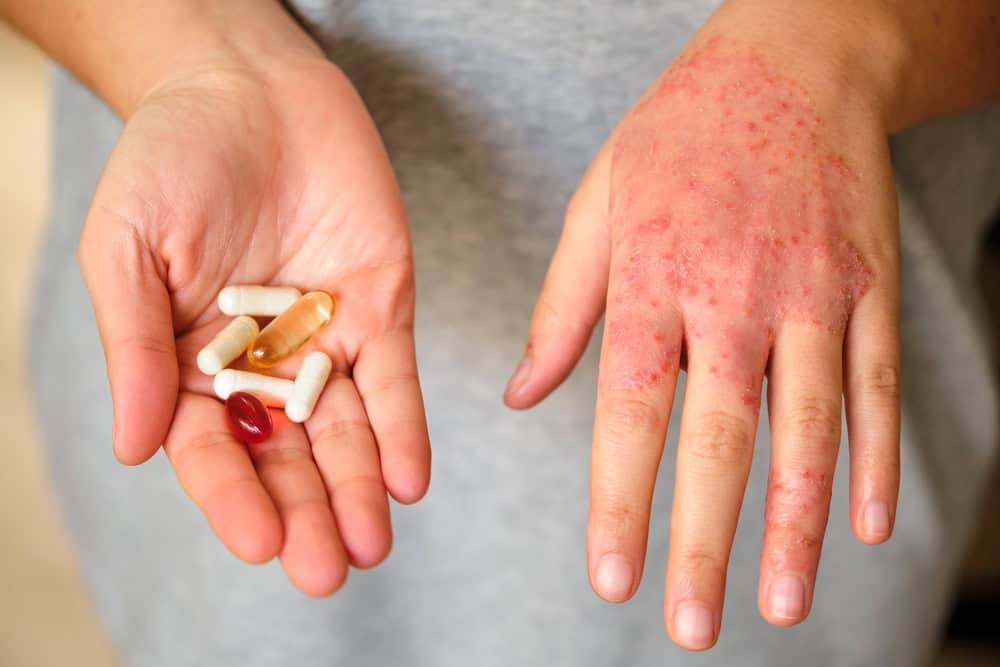 Why Drug Abuse is Not Just Harming Your Body, but Your Skin Too ...